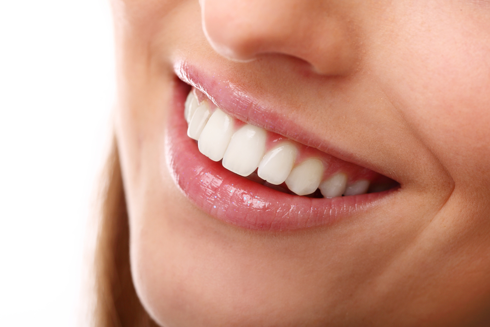 Virginia Beach Smile Makeover With Veneers Hampton Roads Center For